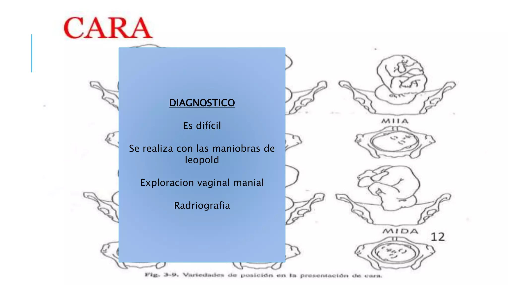Distocia fetal | PPTX