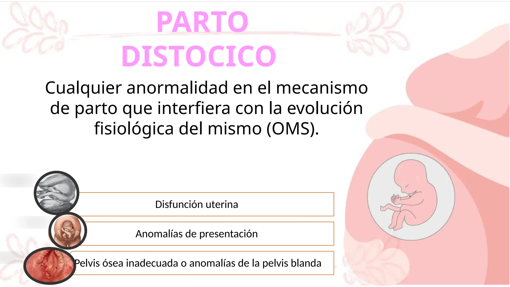 distocia fetales clasificación complicaciones.pptx