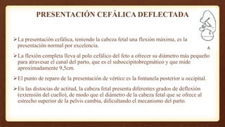 OBSTETRICIA: Distocias | PPTX