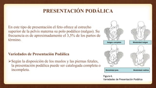 OBSTETRICIA: Distocias | PPTX