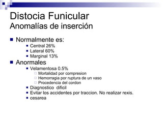 Distocias Funiculares | PPT