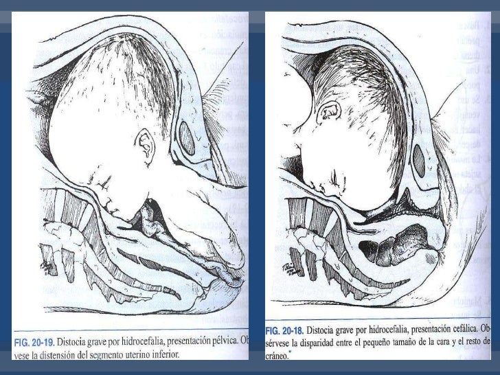 EL CAMINO HACIA LA BUENA CODIFICACIÓN CLÍNICA: CODIFICACIÓN CLÍNICA DE ...