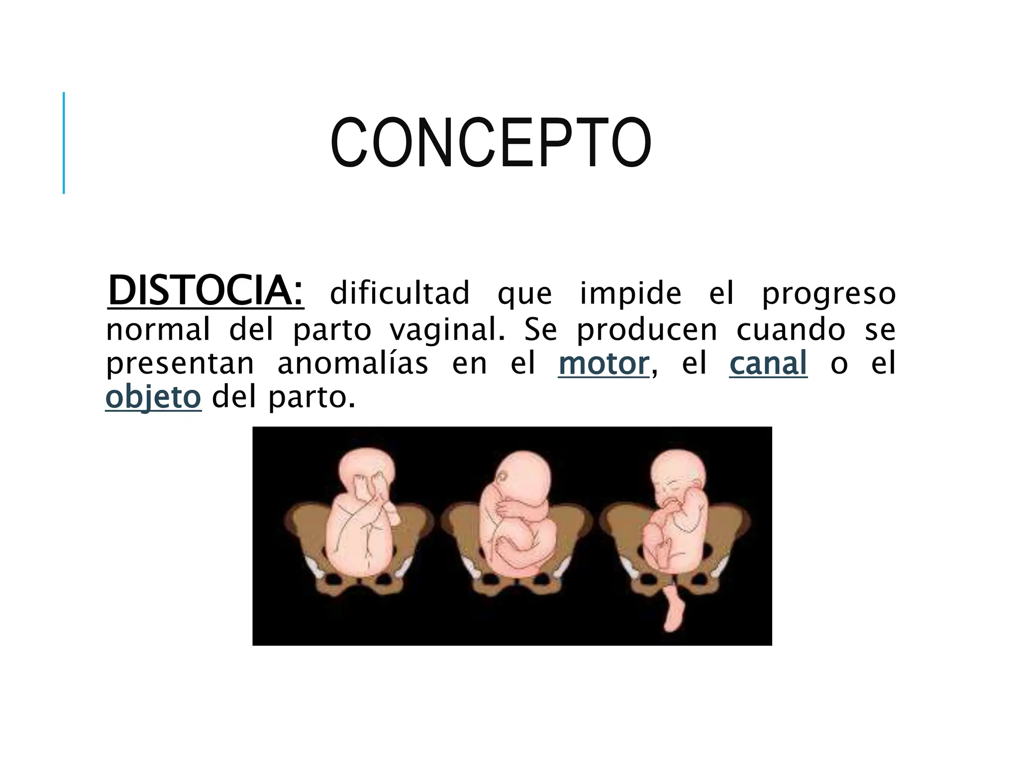 ginecoobstetricia distocias del parto nuevo.pptx