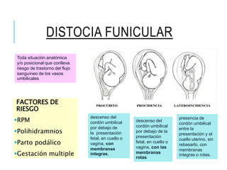 ginecoobstetricia distocias del parto nuevo.pptx
