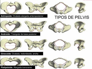 Distocias de origen materno | PPT