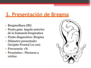 DISTOCIAS DE PRESENTACION-CASO CLINICO- LUIS.pptx