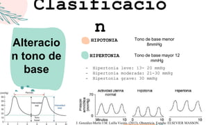 distocias dinamicas.pptx