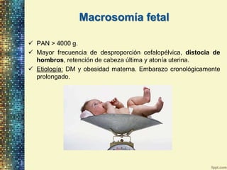 Distocias por exceso de volumen fetal | PPTX