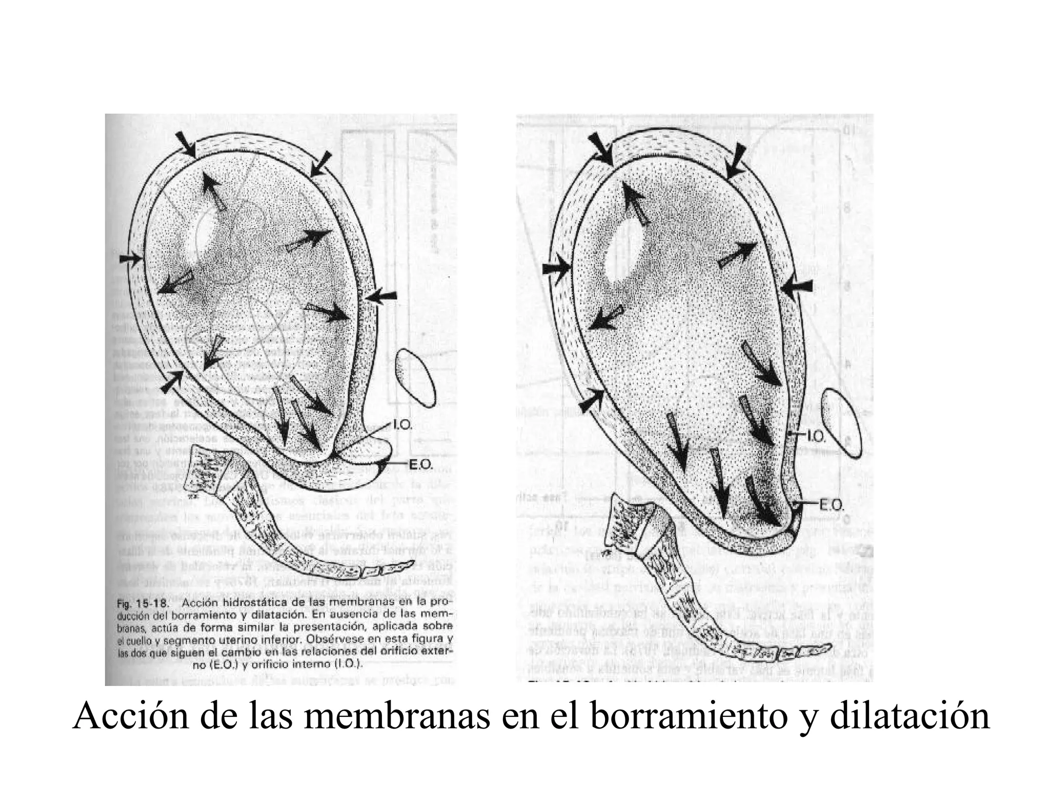 Distocias por la duracion del parto | PPT
