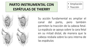 Distocias y parto instrumentado | PPT