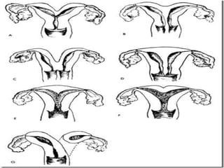 Distokia jalan lahir/reguler poltekkes surakarta | PPTX