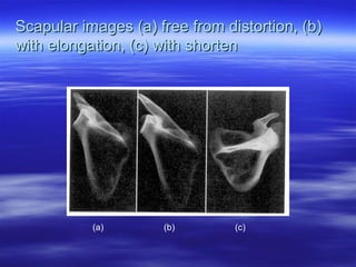 Distortion | PPT