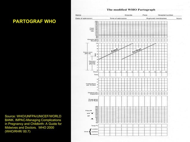 distosia dalam persalinan dan tata laksana | PPT