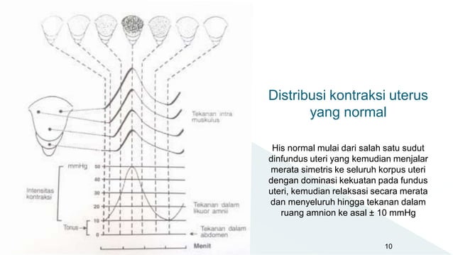 DISTOSIA-EC-KELAINAN-KONTRAKSI.ppt