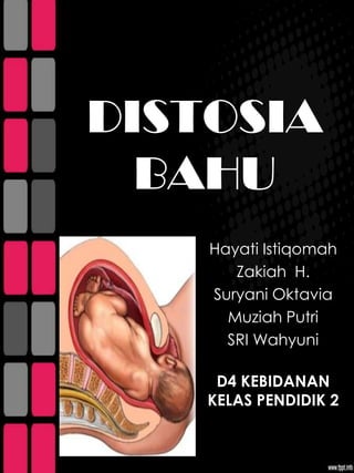 Distosia bahu | PPTX