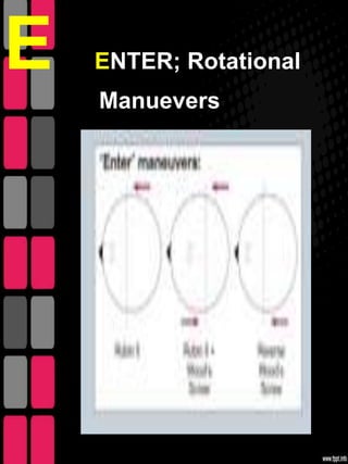 Distosia bahu | PPTX