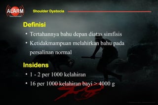 Distosia bahu (Penyulit pada Persalinan) | PPT