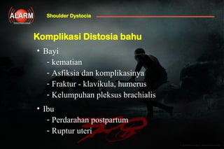 Distosia bahu (Penyulit pada Persalinan) | PPT