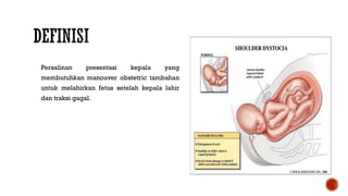Distosia bahu | PPT