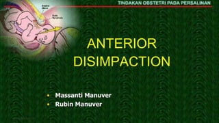 Distosia bahu dan sistem rujukan.......... | PPT