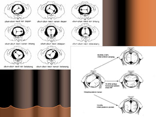 Distosia & Kelainan Letak Malposisi.ppt