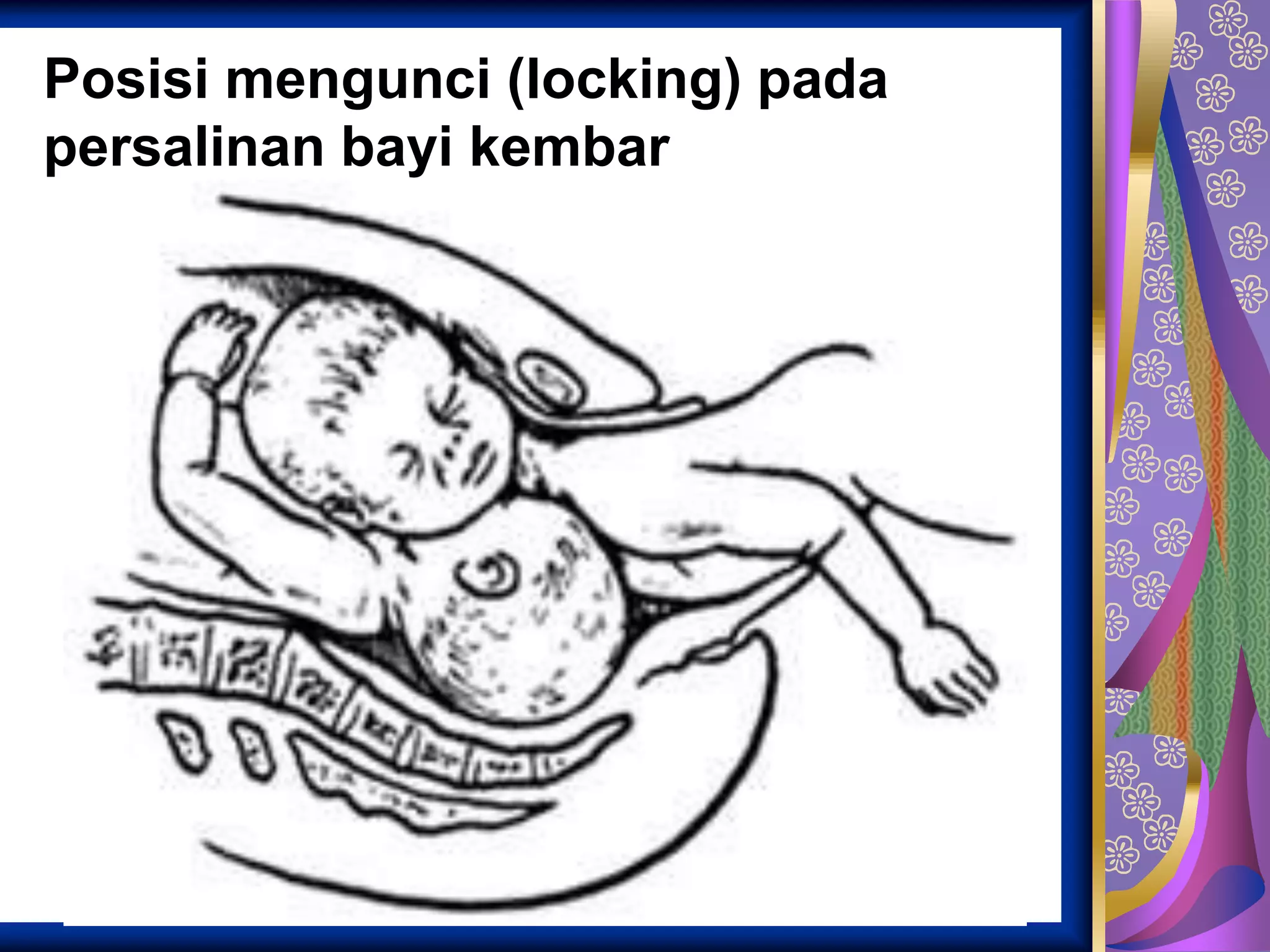 DISTOSIA PERSALINAN.pptx