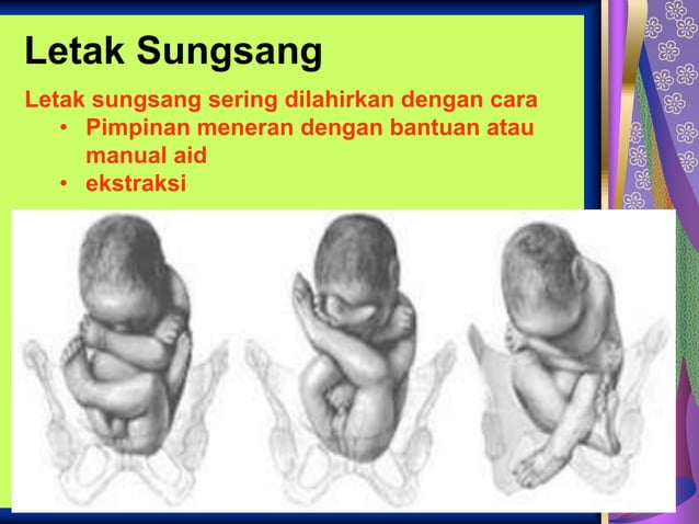 DISTOSIA PERSALINAN.pptx