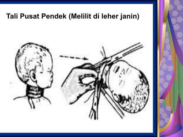 DISTOSIA PERSALINAN.pptx