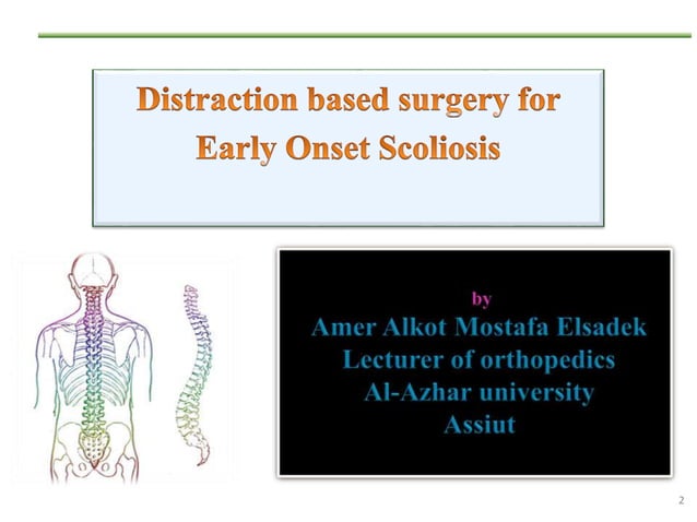 Distraction based surgery 30 | PPT