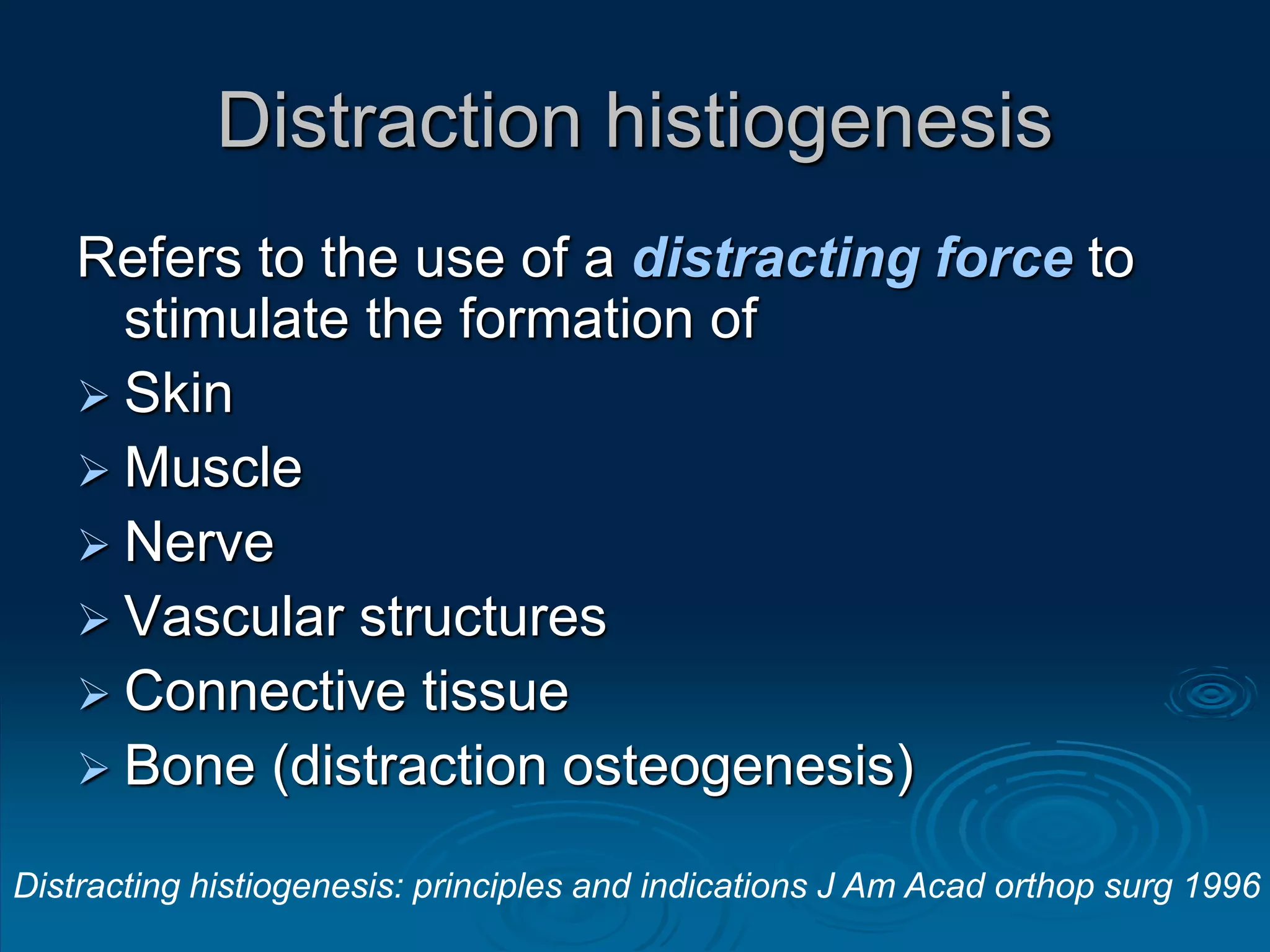 Distraction histogenesis in Ilizarov | PPT