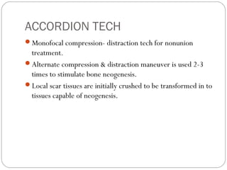 Distraction osteogenesis | PPT