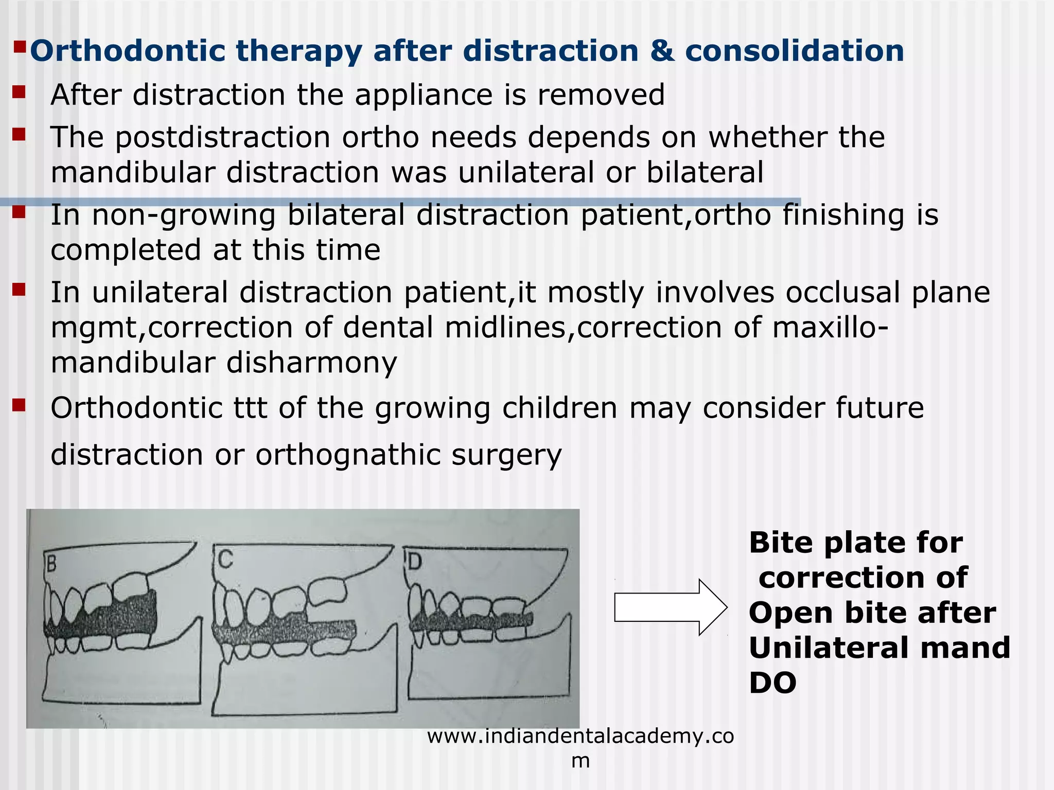 Distraction osteogenesis | PPT