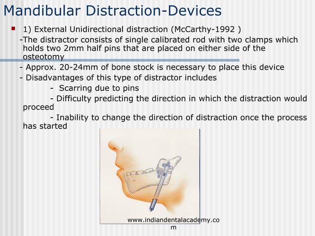 Distraction osteogenesis | PPT