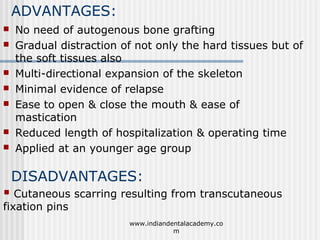 Distraction osteogenesis | PPT