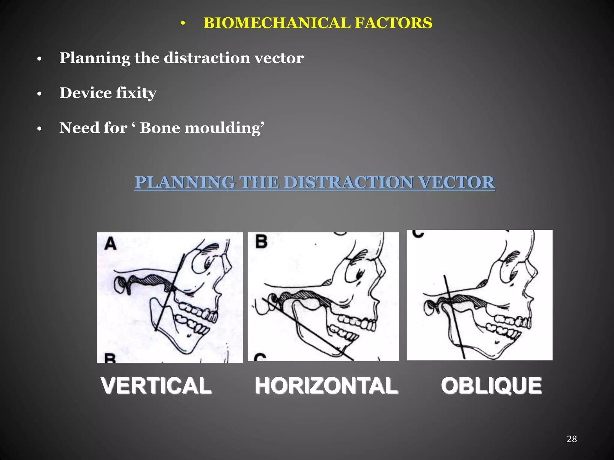 Distraction osteogenesis | PPTX