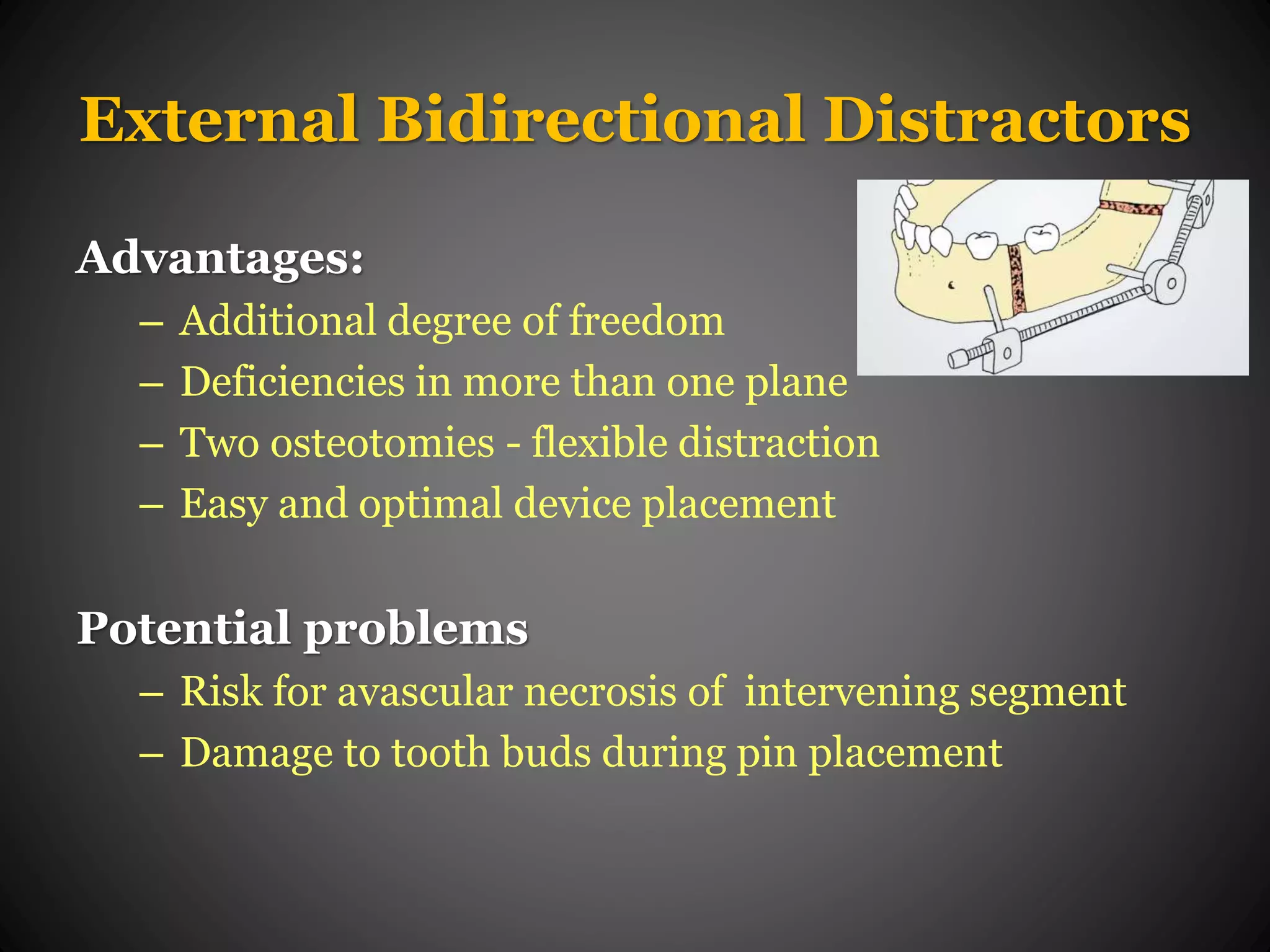 Distraction osteogenesis | PPTX