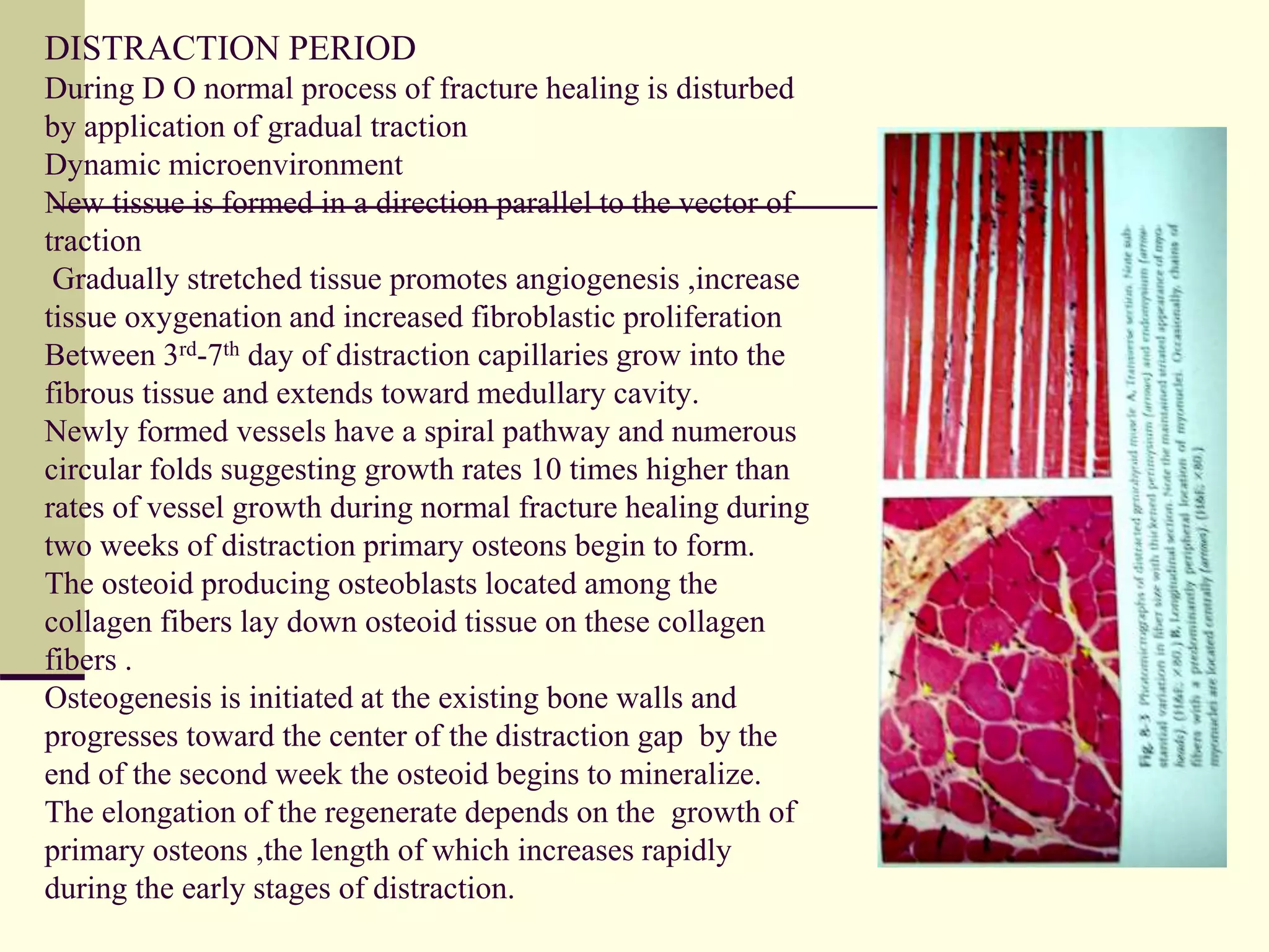 Distraction Osteogenesis | PPT