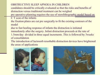 Distraction Osteogenesis | PPT