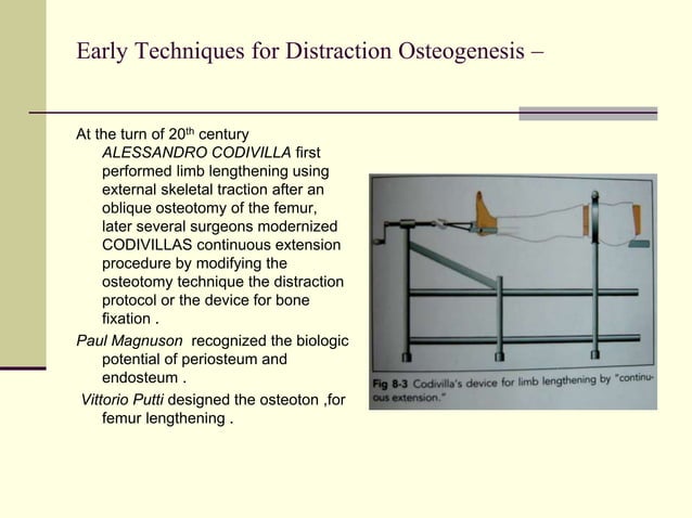 Distraction Osteogenesis | PPT