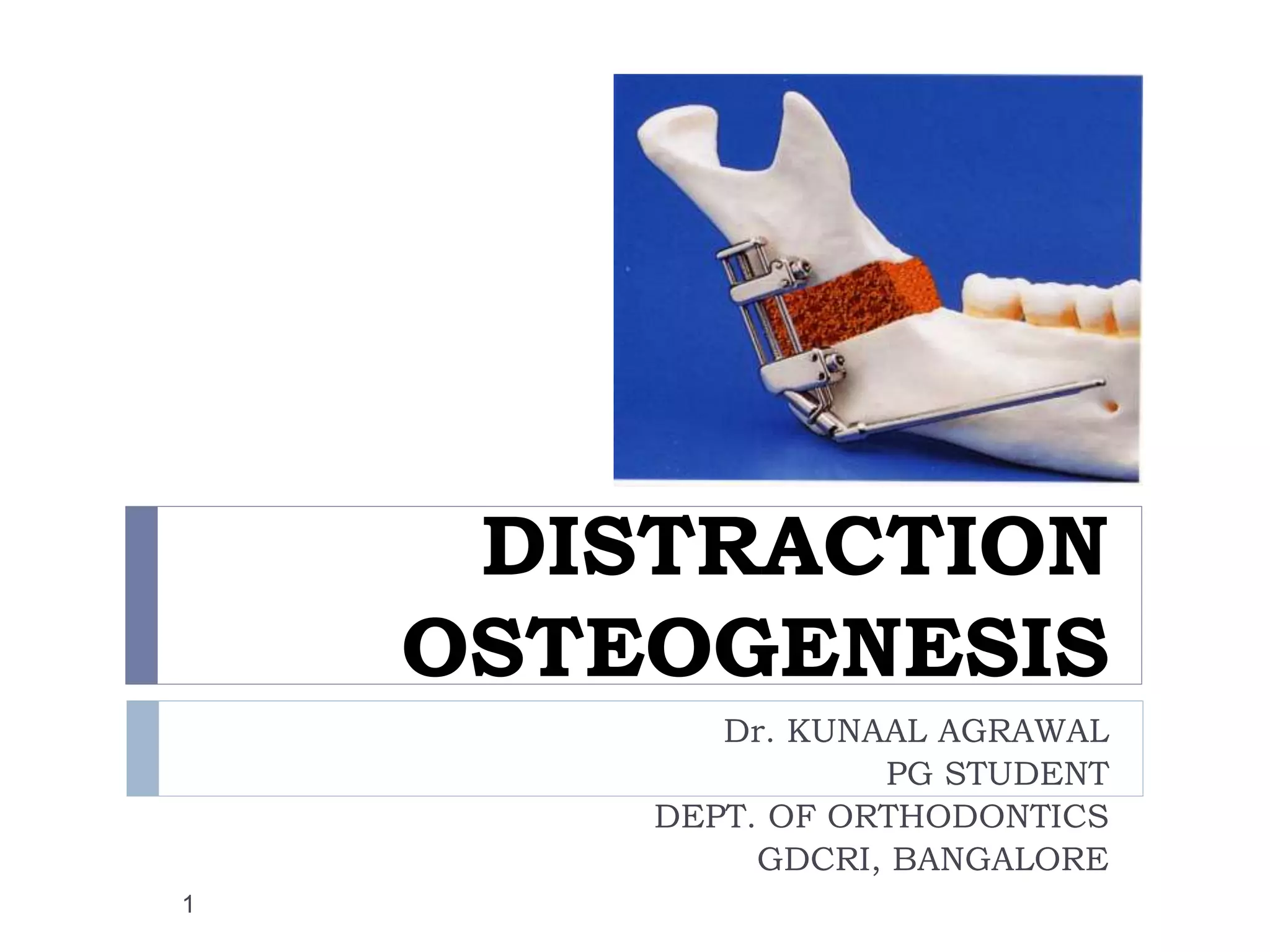 Distraction osteogenesis of craniofacial region | PPTX