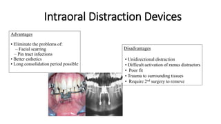 Distraction osteogenesis | PPTX
