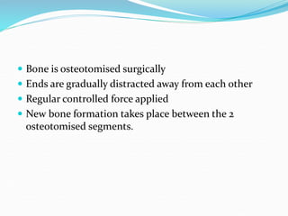 Distraction Osteogenesis.ppt
