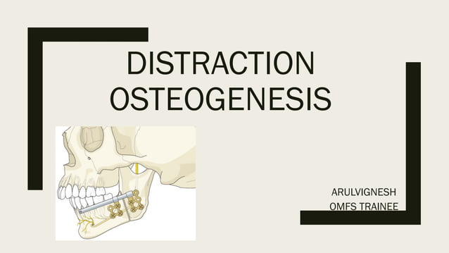 DISTRACTION OSTEOGENESIS OJ JAW OMFS.ppt