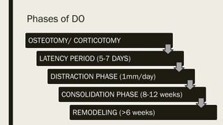 DISTRACTION OSTEOGENESIS OJ JAW OMFS.ppt