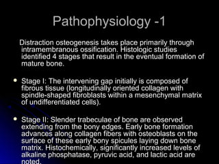 Distraction osteogenesis (5) | PPT