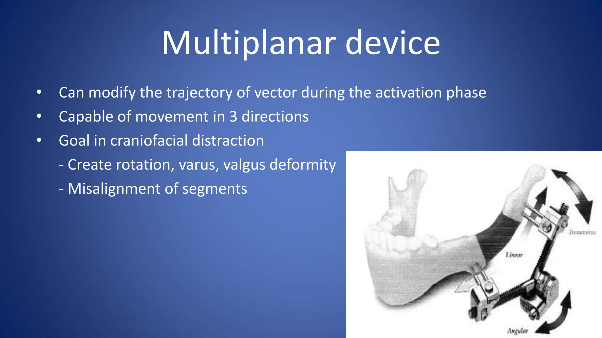 Distraction osteogenesis-Ilizarov AGP.pptx