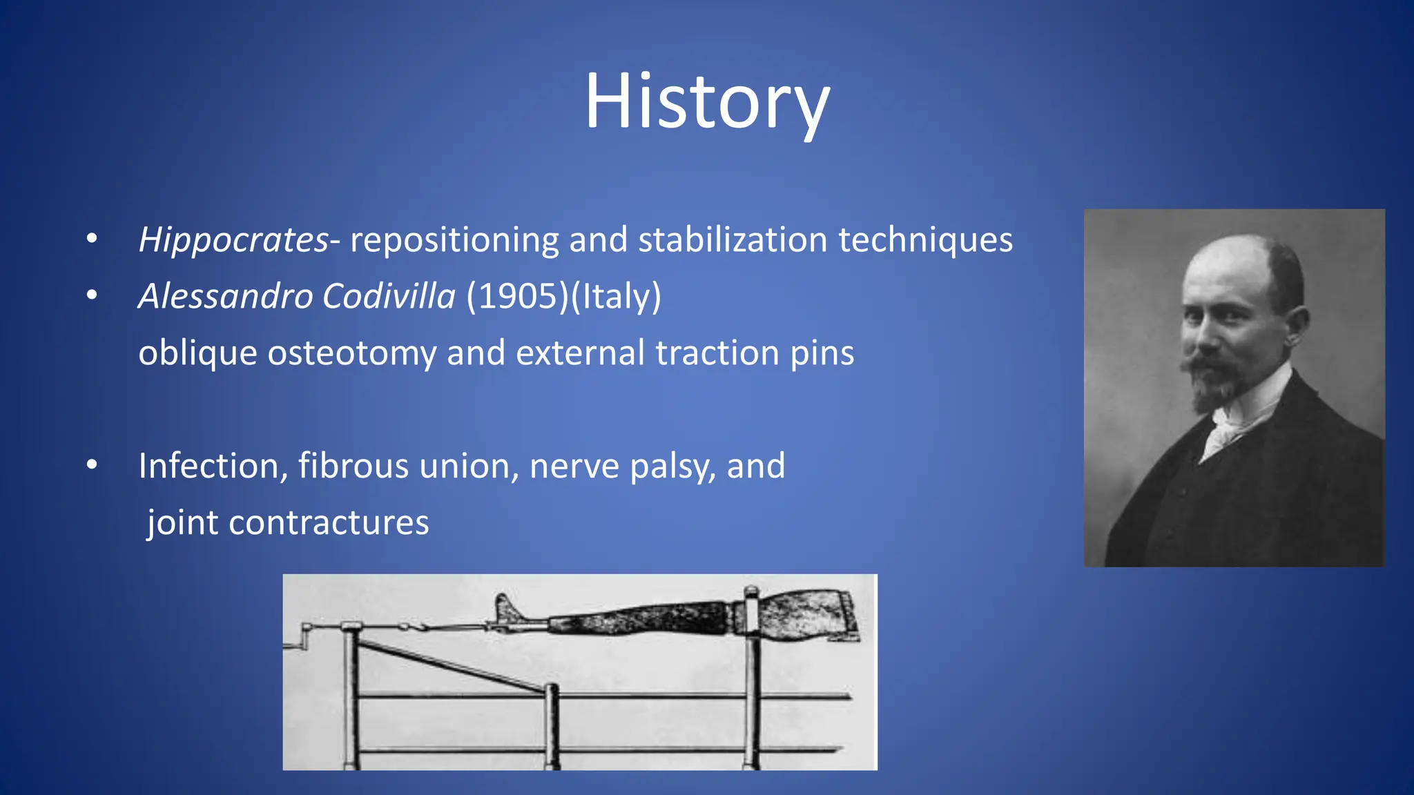 Distraction osteogenesis-Ilizarov AGP.pptx