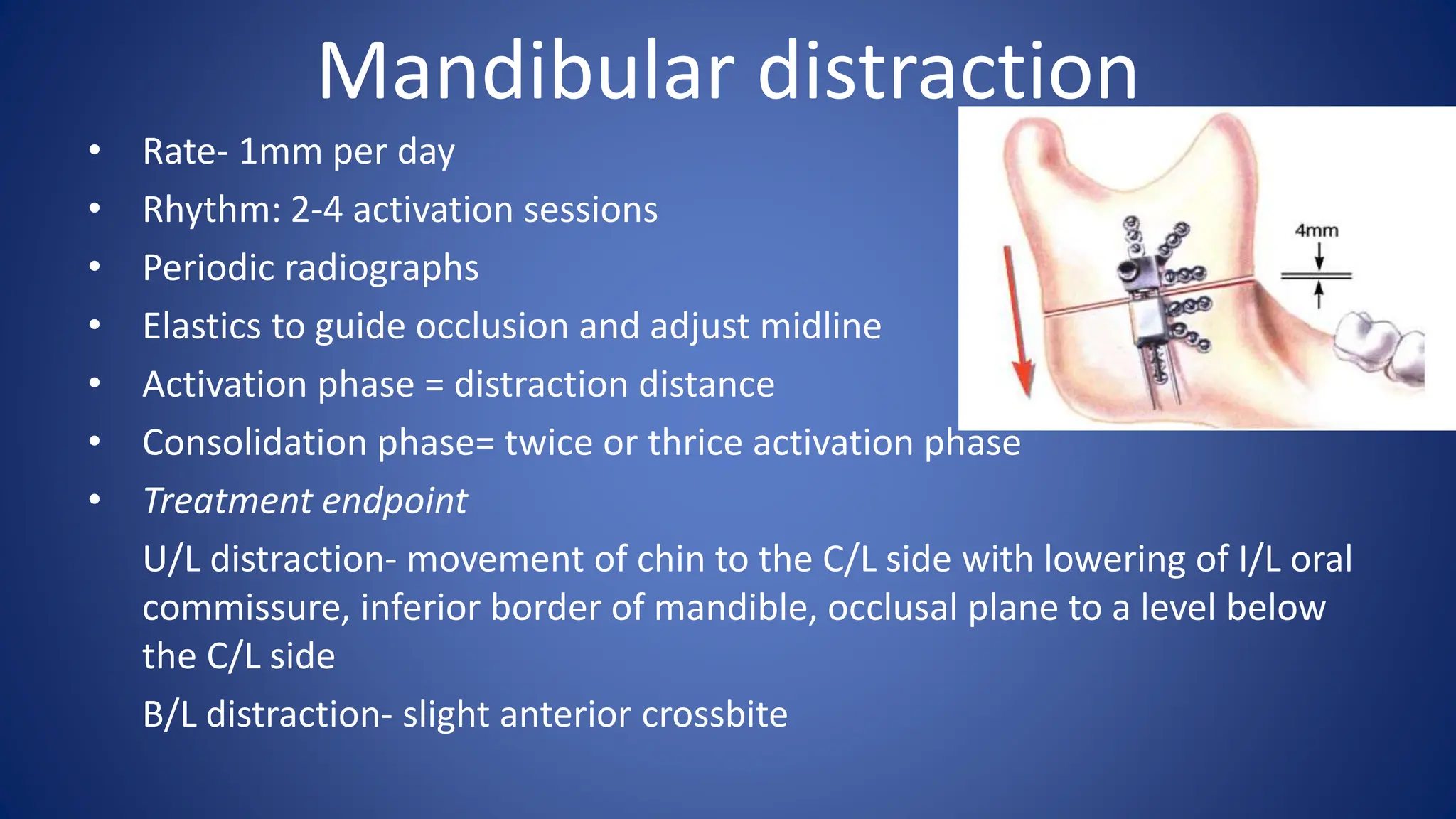 Distraction osteogenesis-Ilizarov AGP.pptx