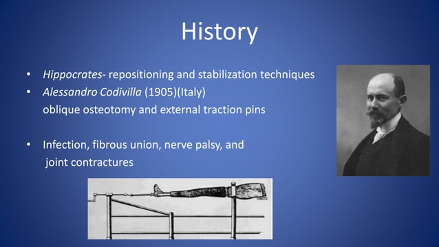 Distraction osteogenesis-Ilizarov AGP.pptx
