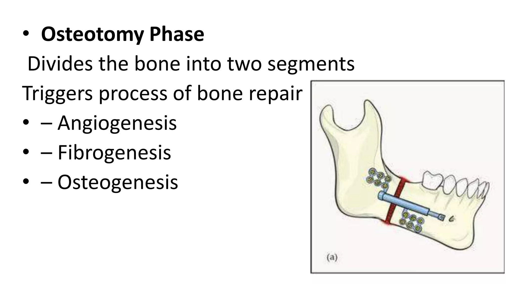 Distraction osteogenesis in orthodontics -Dr.G V SHETTY | PPTX